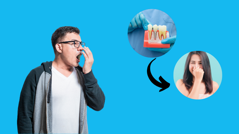 How to Handle Post-Root Canal Discomfort?