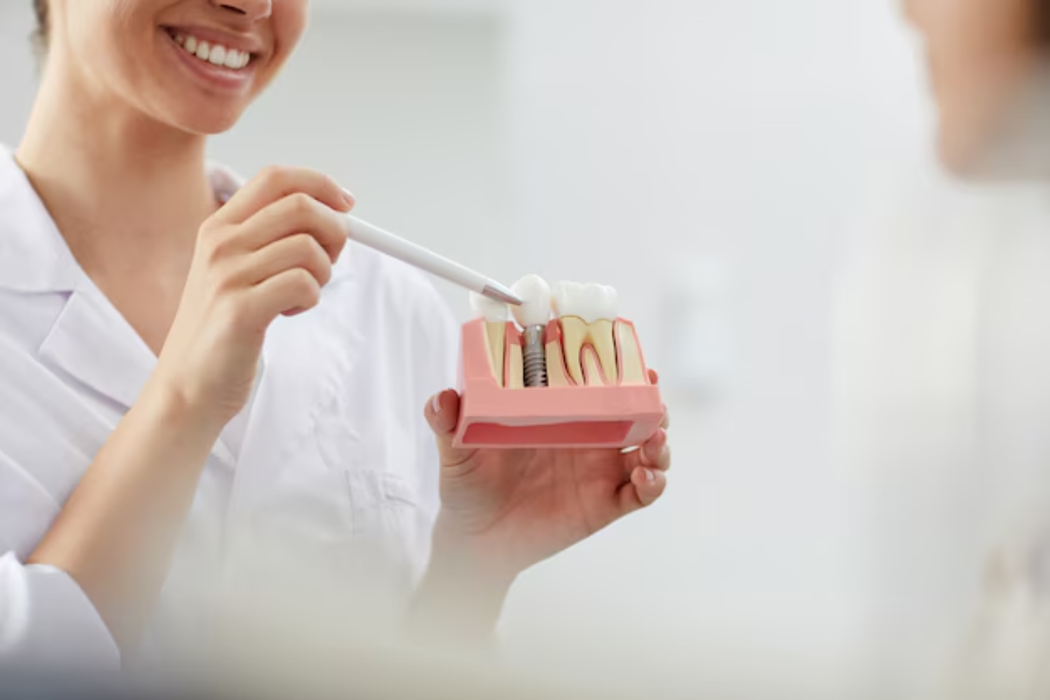 How to Care for Your Dental Implants: Essential Tips for Longevity